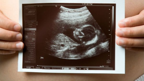 The fertility work-up - Today's Parent - Today's Parent