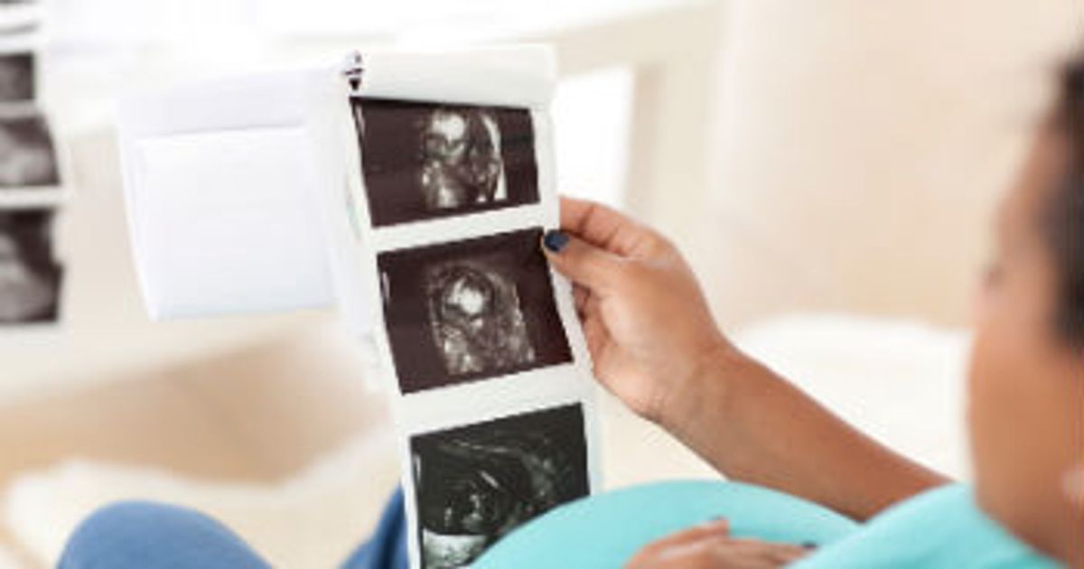 What prenatal testing can tell you - Today's Parent