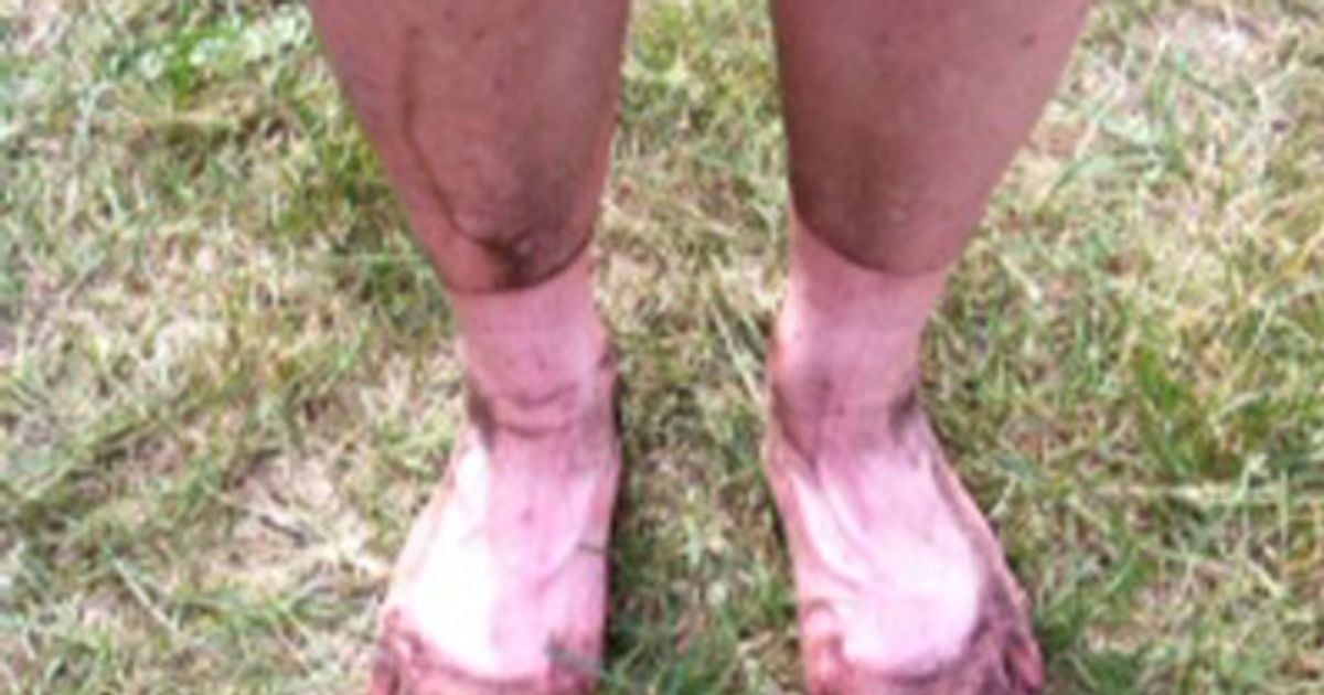 Race report: Tread 6-hour trail race - Today's Parent