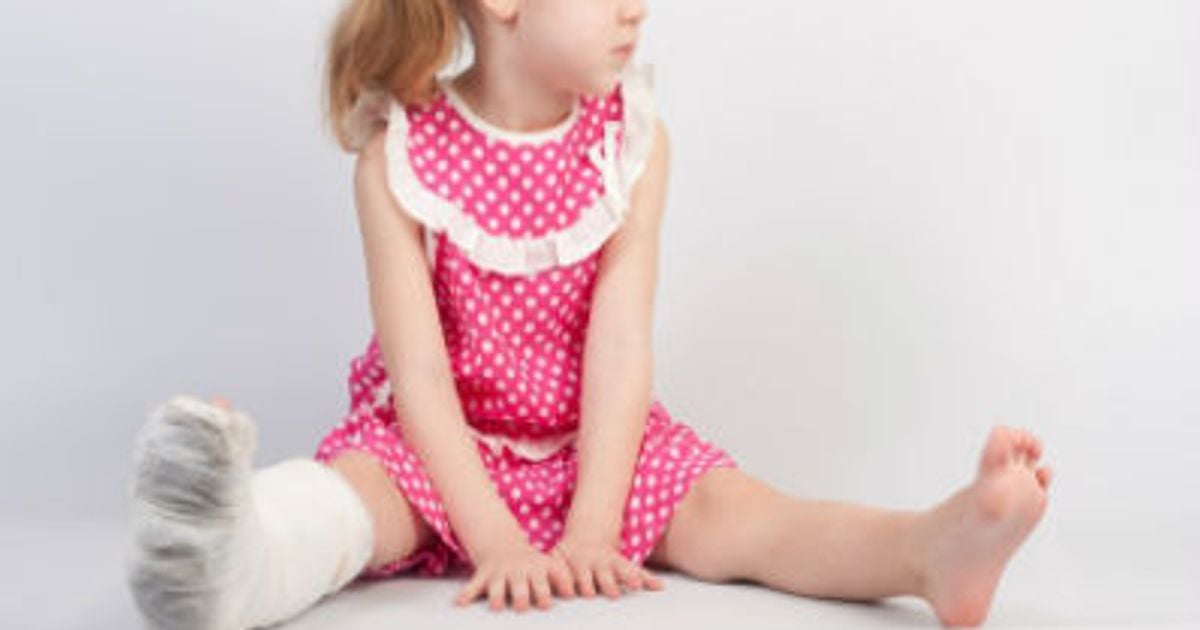 How to deal with a child's first fracture - Today's Parent
