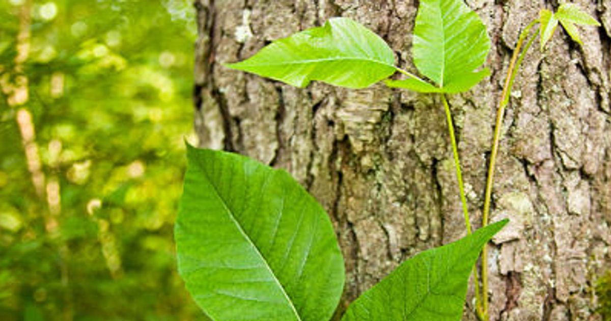 Itchy and scratchy: Poison ivy in children - Today's Parent