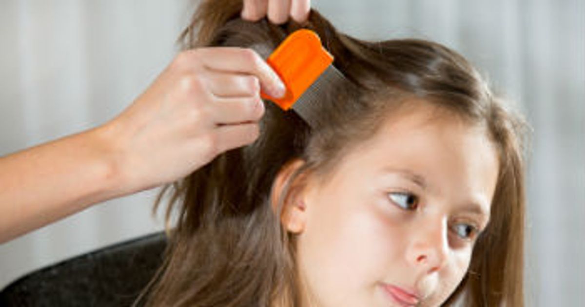 3 steps for treating head lice - Today's Parent