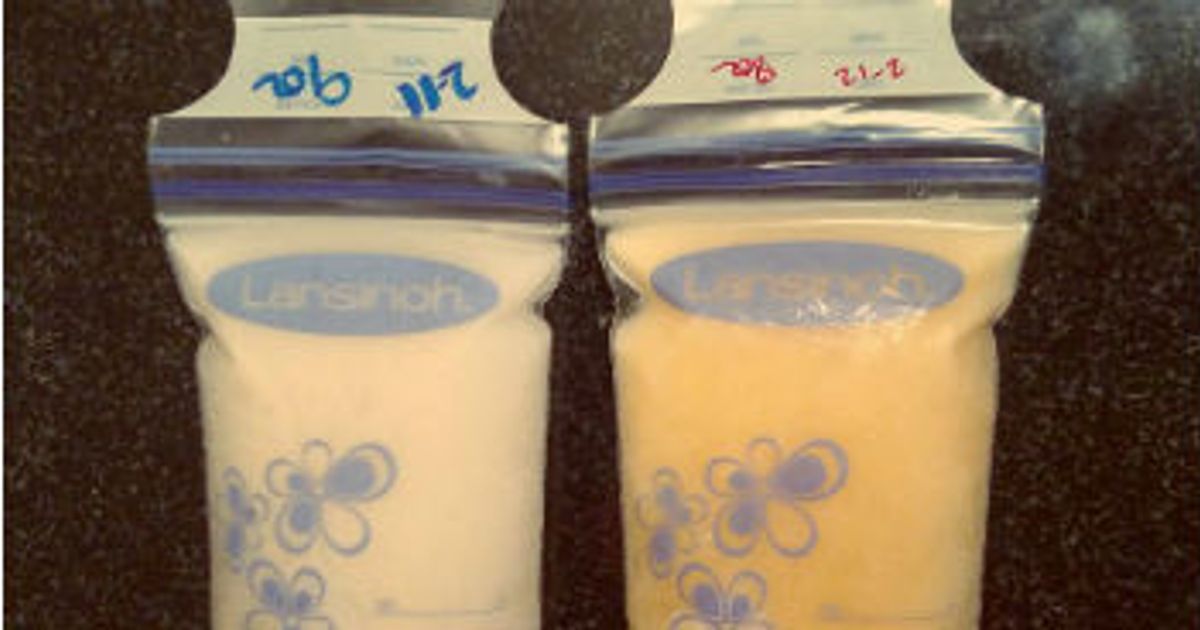 This photo shows the magical powers of breastmilk - Today's Parent