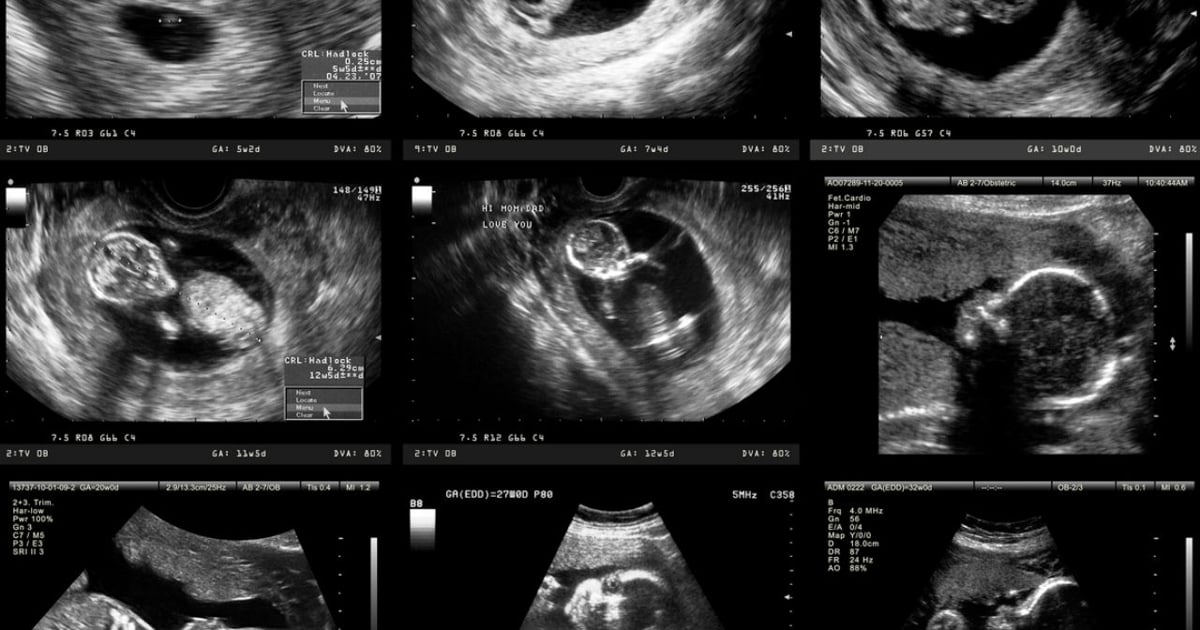 Cool or scary? This video of an unborn baby is fascinating - Today's Parent