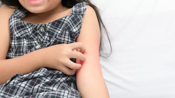 5 most common kid skin rashes and sensitivities (and how to soothe them ...