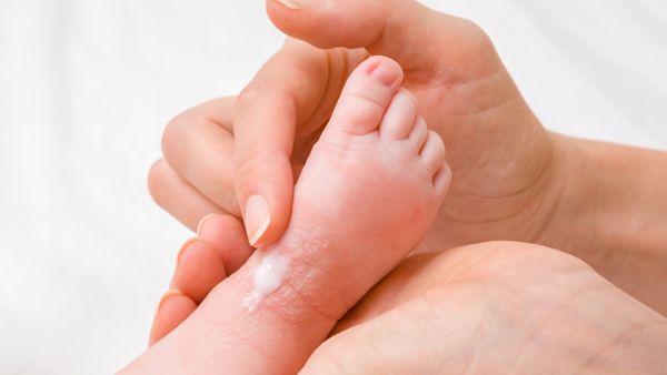 5 most common kid skin rashes and sensitivities (and how to soothe them ...