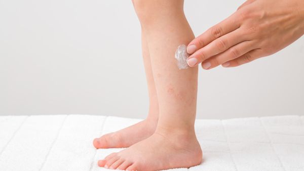 5 most common kid skin rashes and sensitivities (and how to soothe them ...
