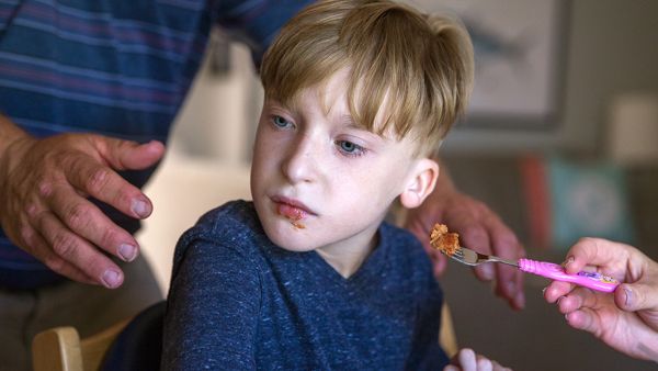 What life is like for kids with rare genetic conditions - Today's Parent