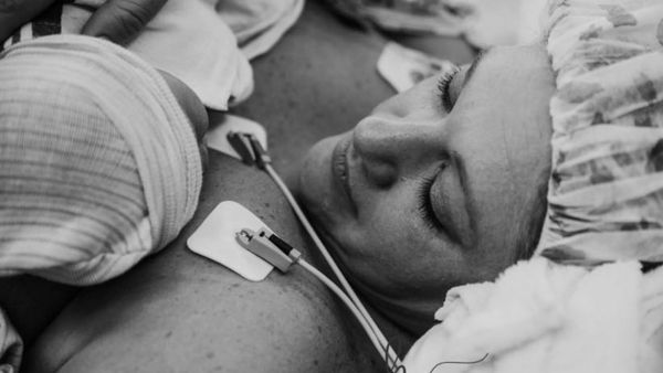 This mom pulled her baby out during her C-section—and the photos are ...