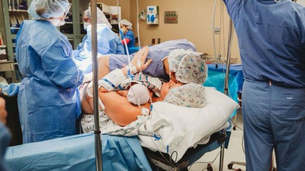 This mom pulled her baby out during her C-section—and the photos are ...