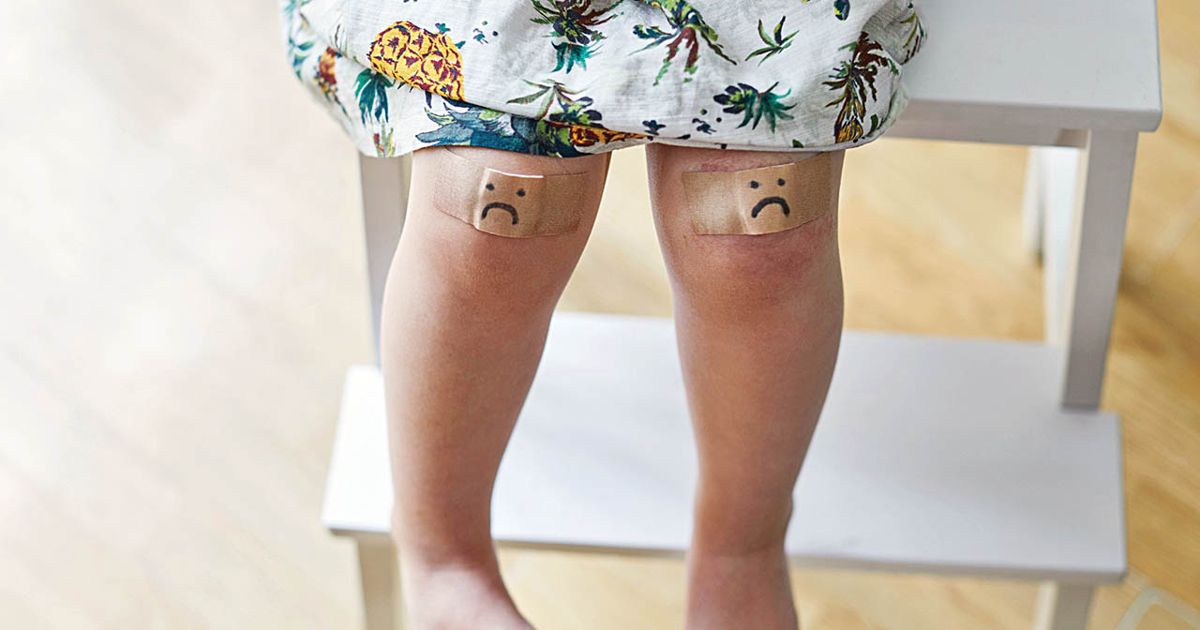 Should you be worried about your clumsy toddler? - Today's Parent