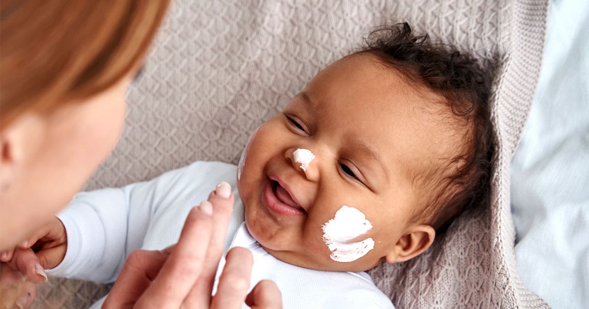 3 common baby skin conditions and how to treat them - Today's Parent