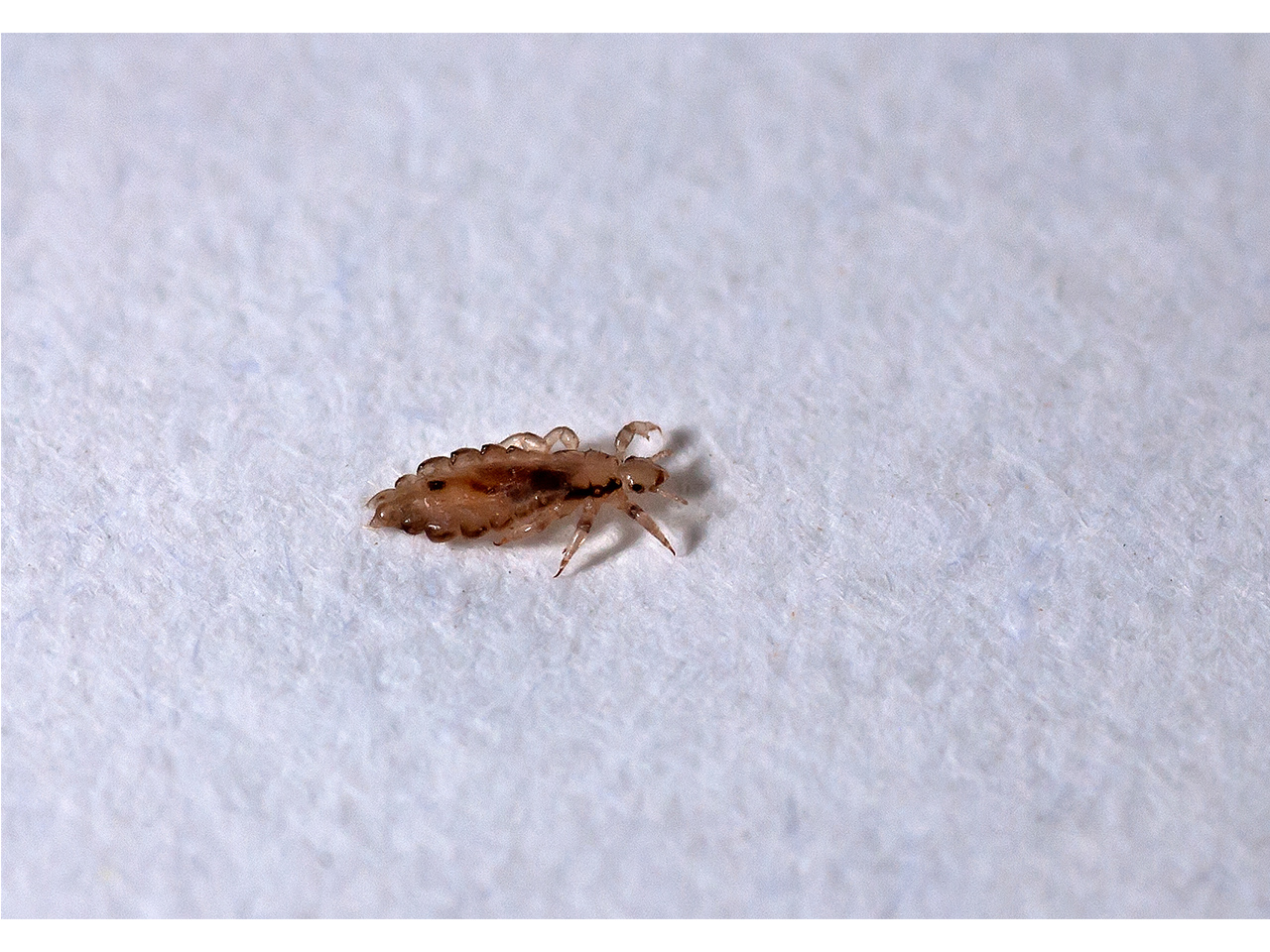 What Do Head Lice Eggs Look Like In Hair Infoupdate